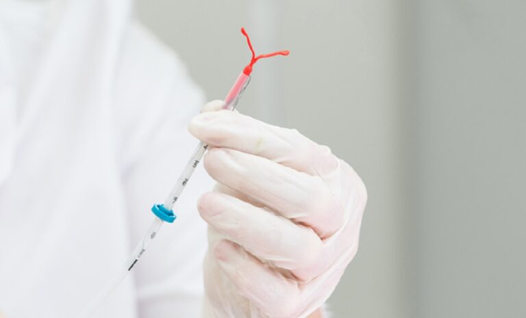 ¿El DIU anticonceptivo Mirena engorda a Adelgaza? | Salud Responde